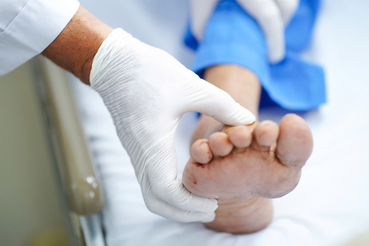 Phẫu thuật lấy dị vật trong mu bàn chân, cứu thầy giáo khỏi cơn đau kéo dài