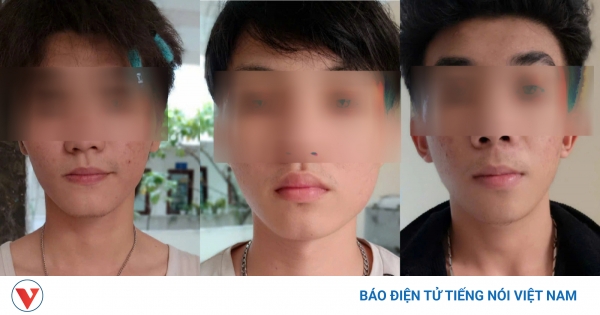 Hùn tiền mua cần sa về sử dụng, 3 sinh viên bị bắt giữ
